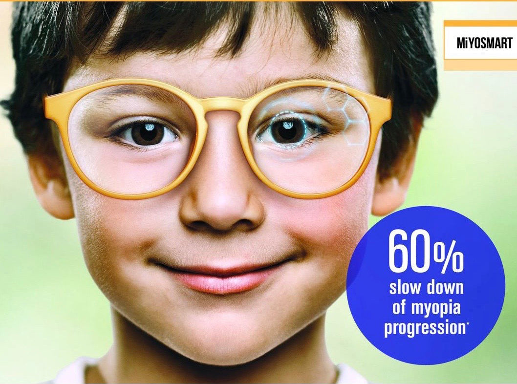 MiyoSmart HOYA Lenses – Advanced Myopia Control for Children – Dream ...
